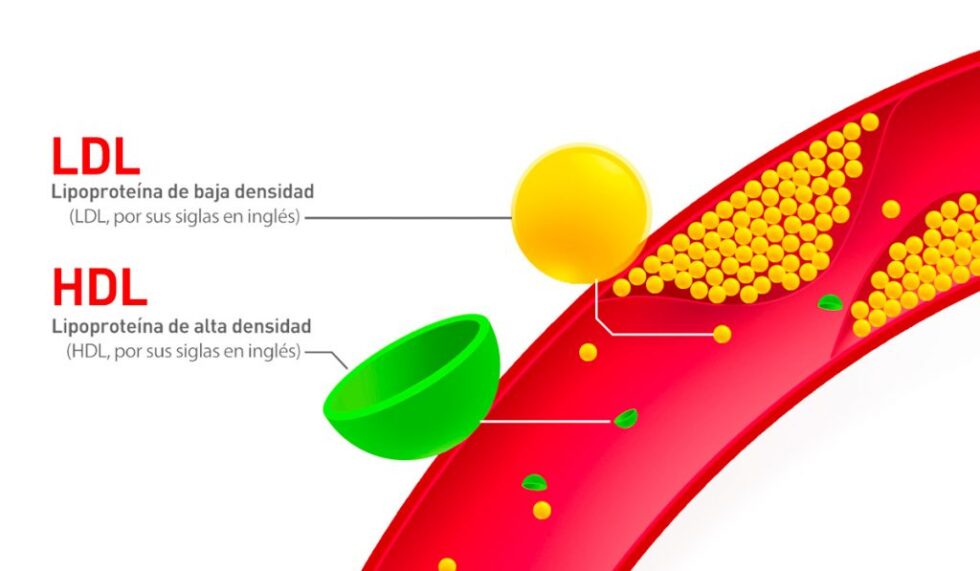 El significado del colesterol LDL y HDL - Caja de la Salud Mendoza