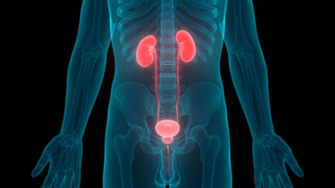 Cálculos en la vejiga: qué los causa, cuáles son los síntomas y cómo ...